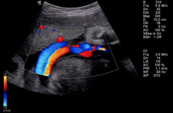 Ecodoppler Vascular - Medicina Estética Pozuelo de Alarcón ...