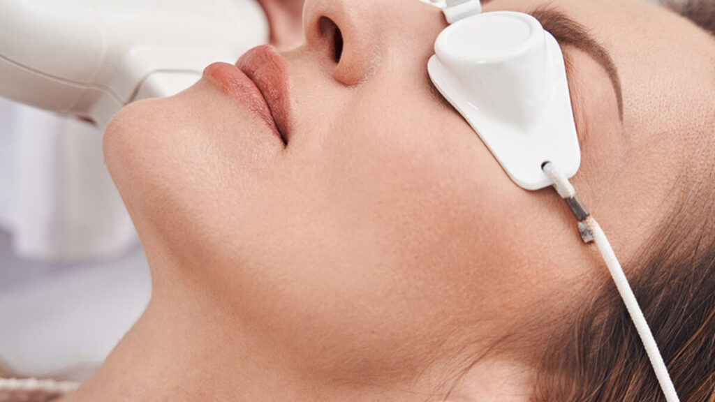 Endolifting Facial Antes y Después. | CLÍNICA BETANCOURT